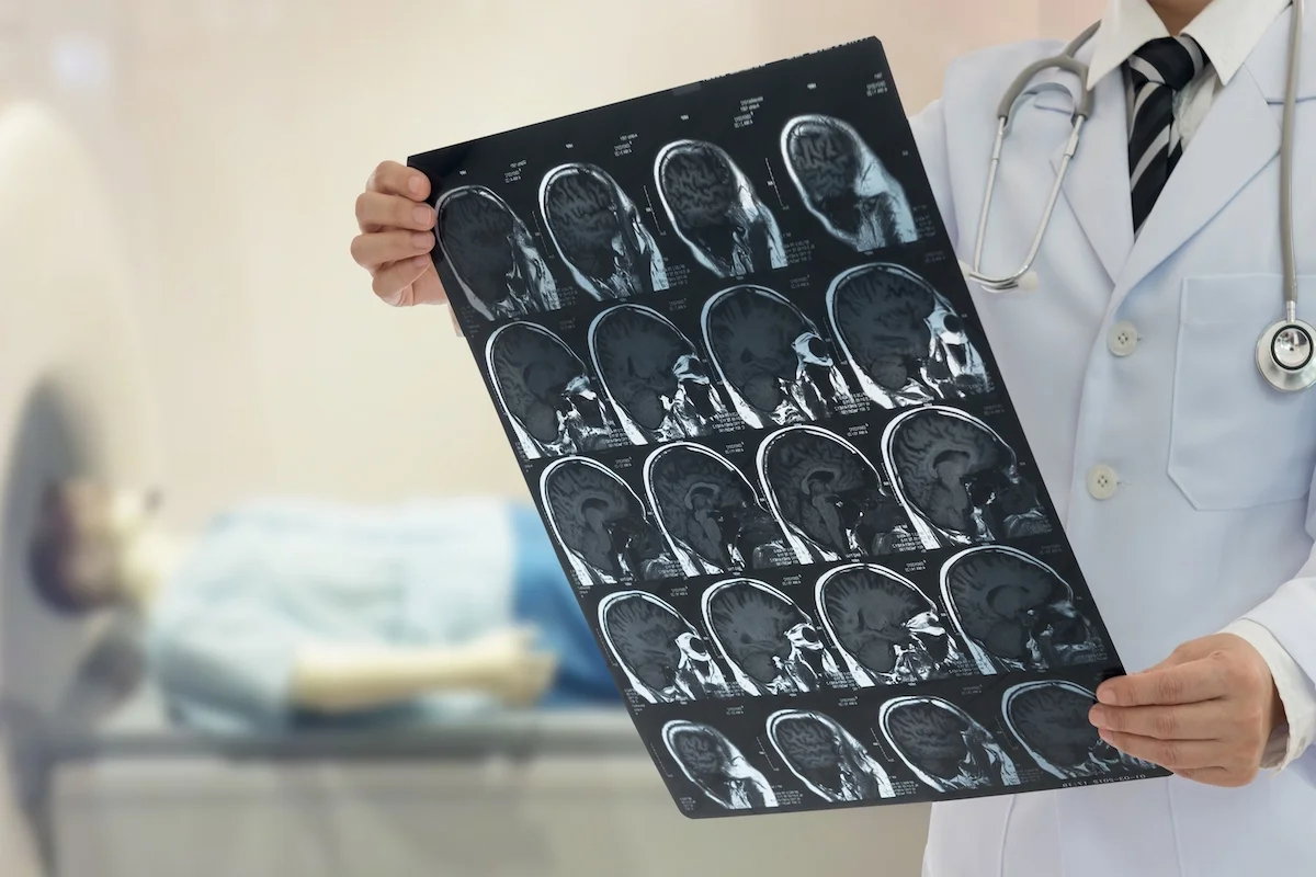 Anoxia: qué es, síntomas y tratamiento - Tua Saúde