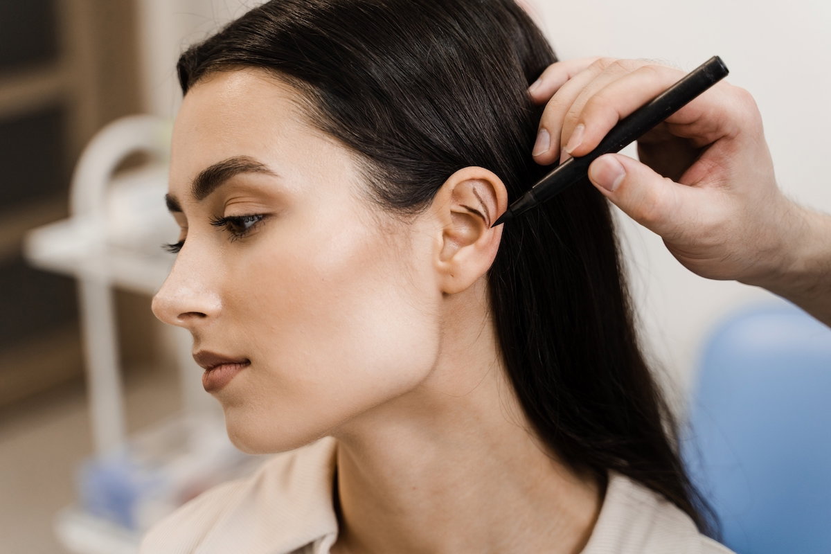 Otoplastia: qué es, cuándo es indicada y cómo se realiza - Tua Saúde