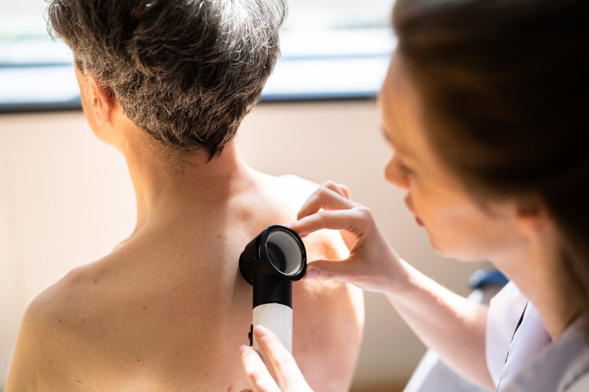 Carcinoma epidermoide: síntomas, diagnóstico, causas y tratamiento ...
