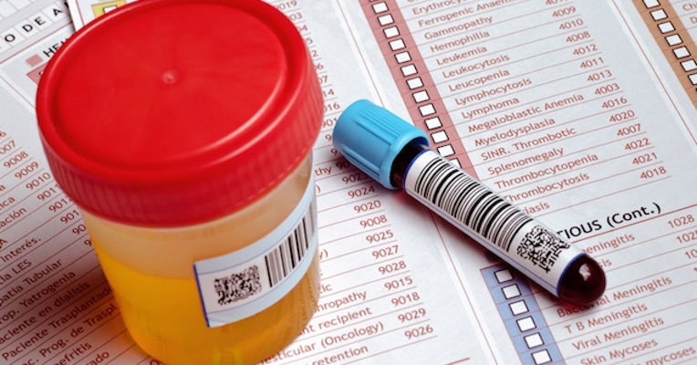 Cortisol Test: What It's For, Types, Normal Levels & Results - Tua Saúde