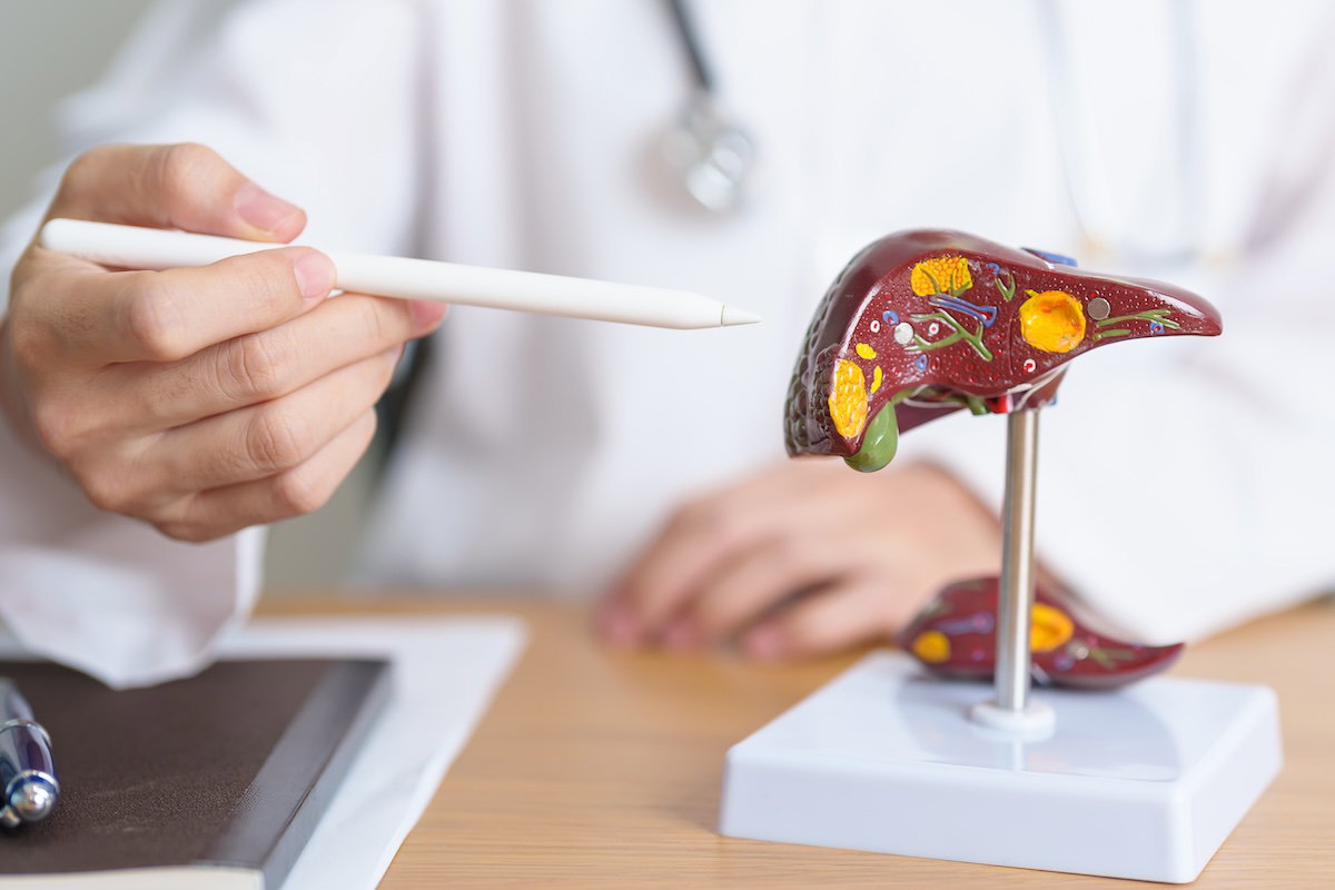 Cytolyse hépatique: symptômes, causes et traitement - Tua Saúde
