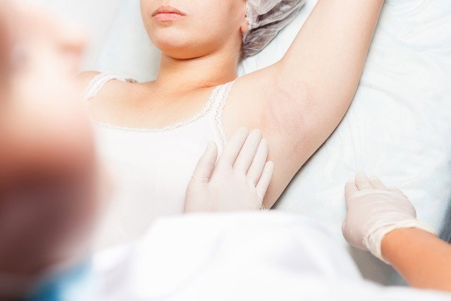 Lump in Armpit: 10 Causes (w/ Pictures) & When to Worry - Tua Saúde