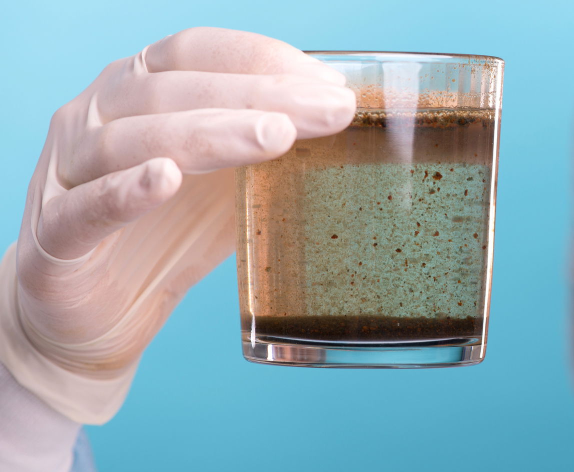 11 enfermedades causadas por agua contaminada - Tua Saúde