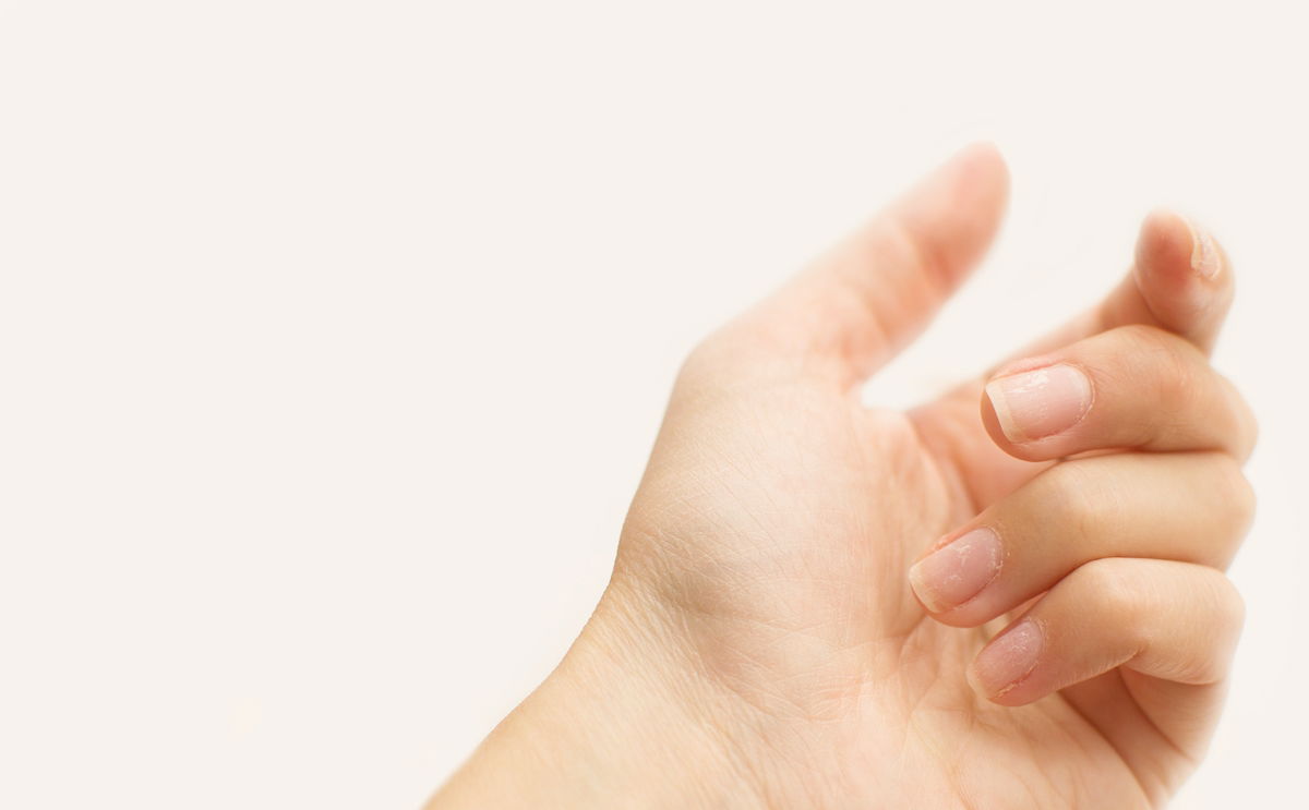 Paroniquia: qué es, síntomas, causas y tratamiento - Tua Saúde