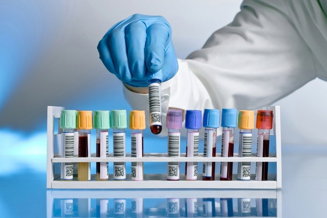 Luteinizing Hormone (LH): What It Is, Normal Levels & Low/High - Tua Saúde