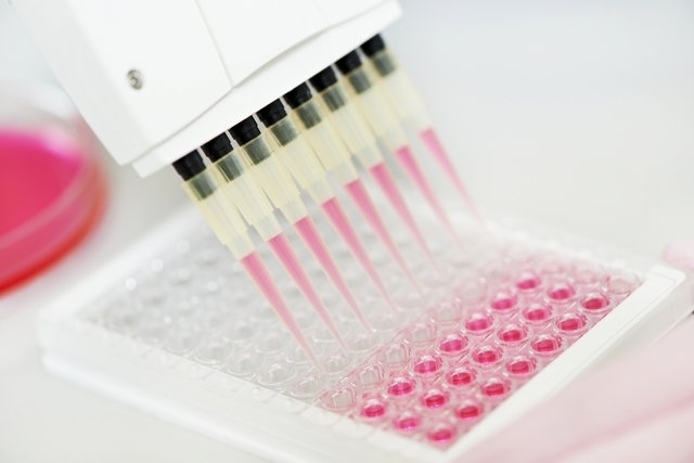 Exame HCV: o que é, para que serve e como é feito - Tua Saúde
