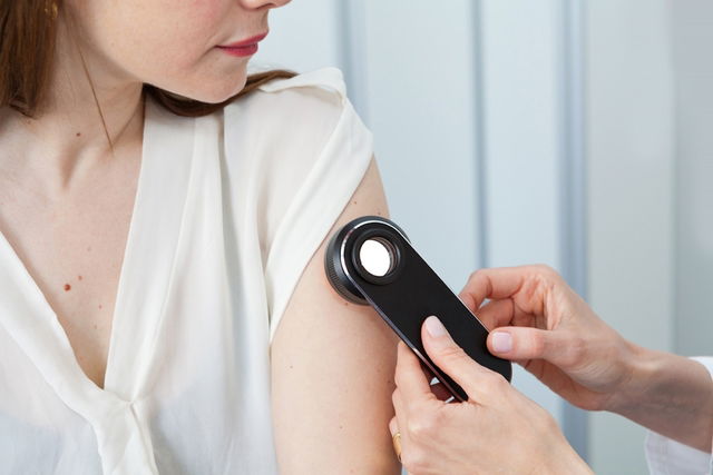 Tipos de manchas en la piel: fotos y principales causas - Tua Saúde