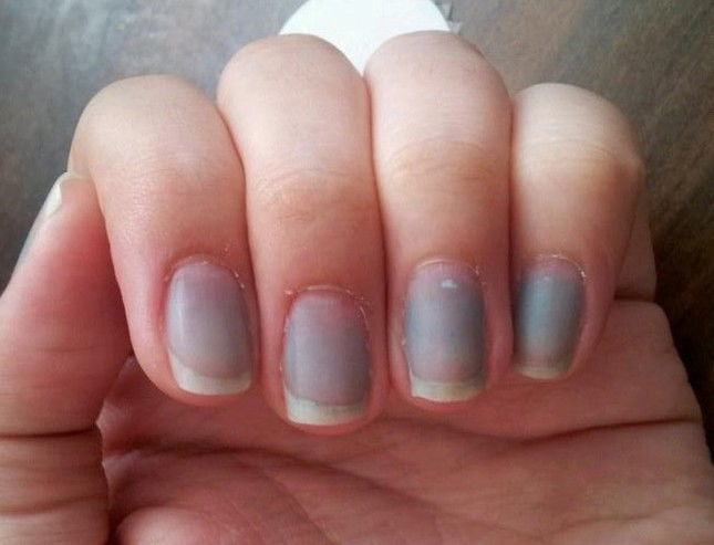 Ongle noir: 6 causes principales (et que faire) - Tua Saúde