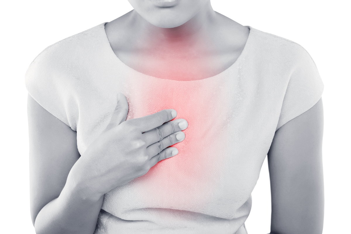 Esofagitis erosiva: qué es, clasificación de Los Ángeles y tratamiento ...