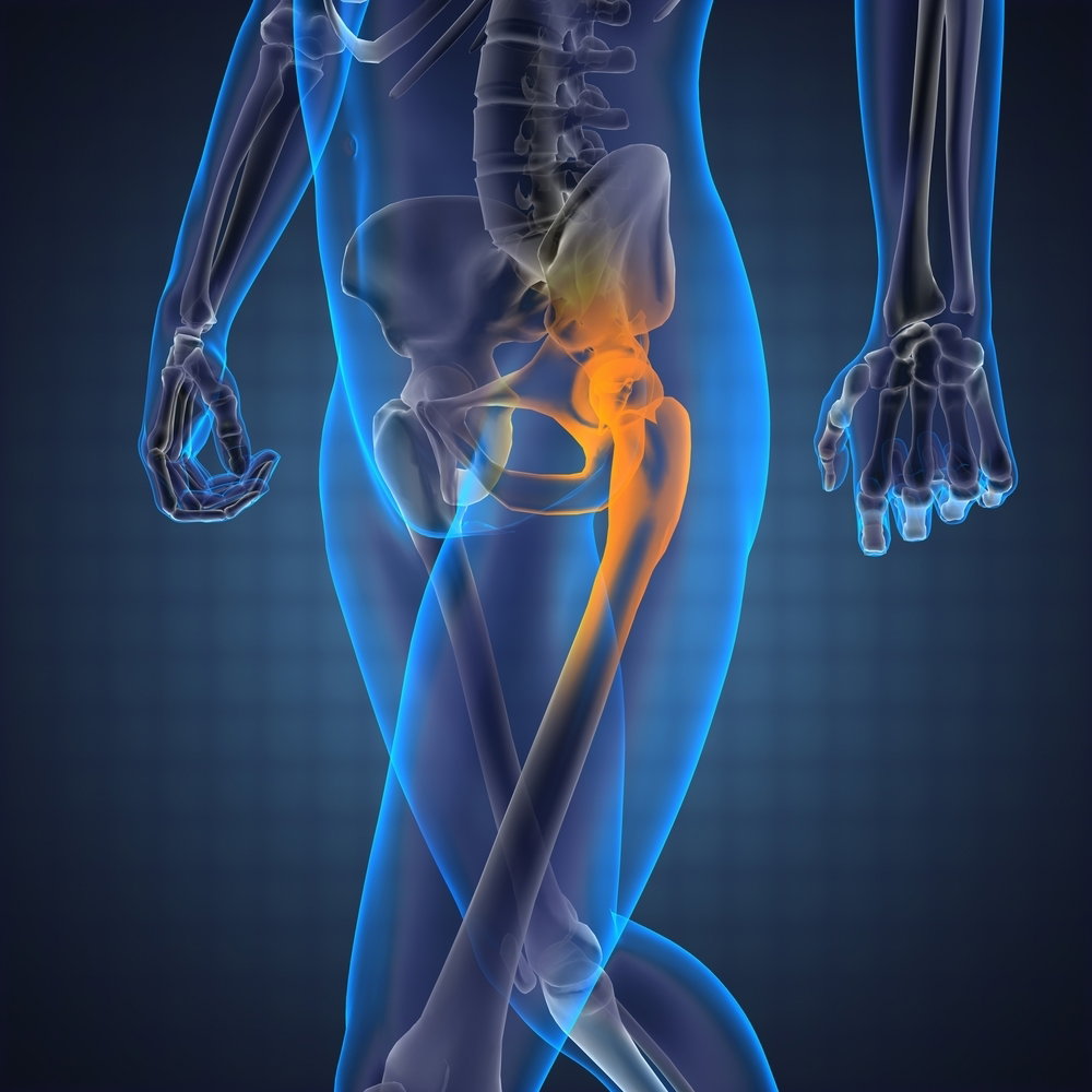 Dolor de cadera: 8 causas comunes y qué hacer - Tua Saúde