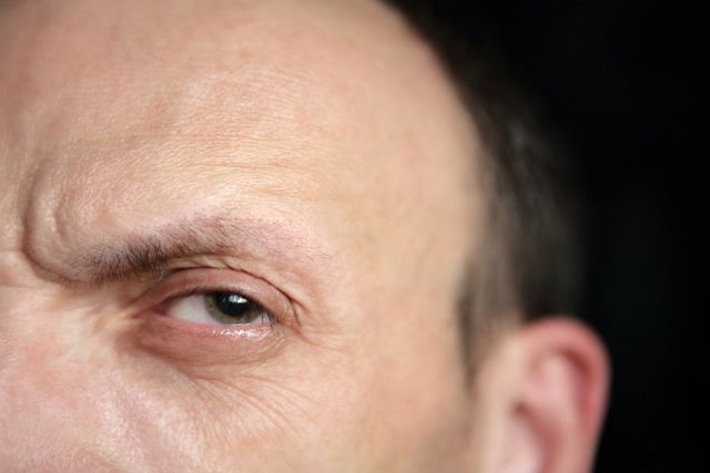 Blefaroespasmo: o que é, causas e tratamento - Tua Saúde