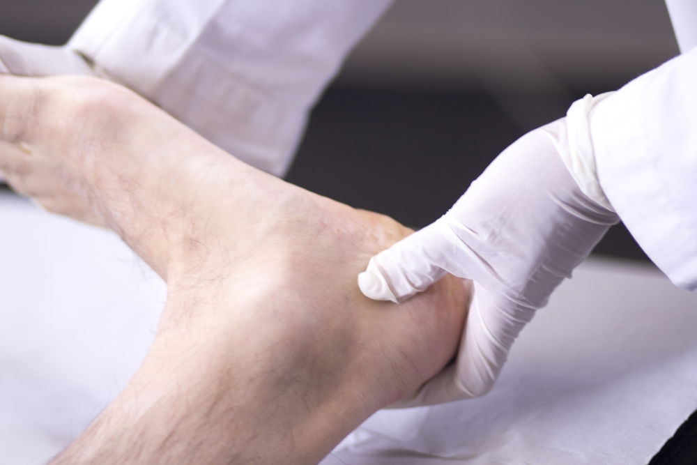 Lepra: o que é, sintomas, transmissão e tratamento - Tua Saúde