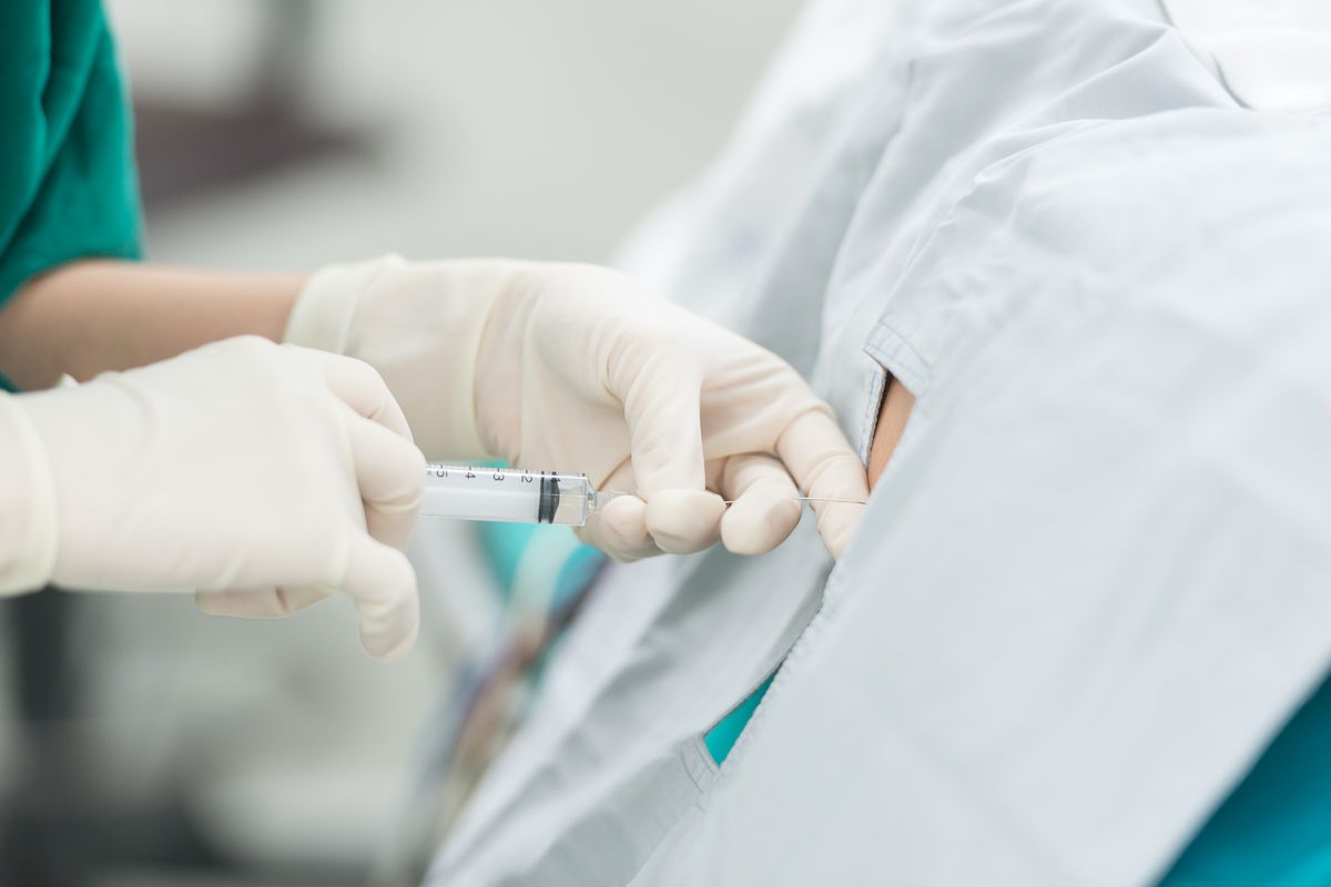 Péridurale: c'est quoi, indications et risques possibles - Tua Saúde