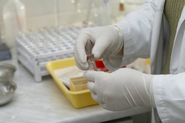 Examen toxicológico: qué es, para qué sirve y cómo se realiza - Tua Saúde