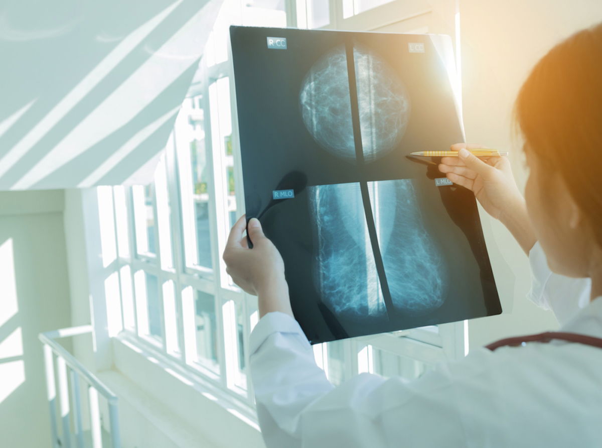 Calcificaciones mamarias: qué son, causas y cómo se diagnostican - Tua ...