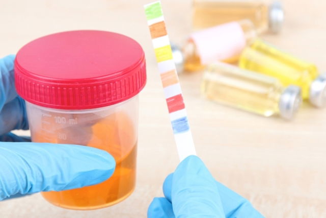 Qué significa el color de la orina: rosada, naranja y otros (y qué ...