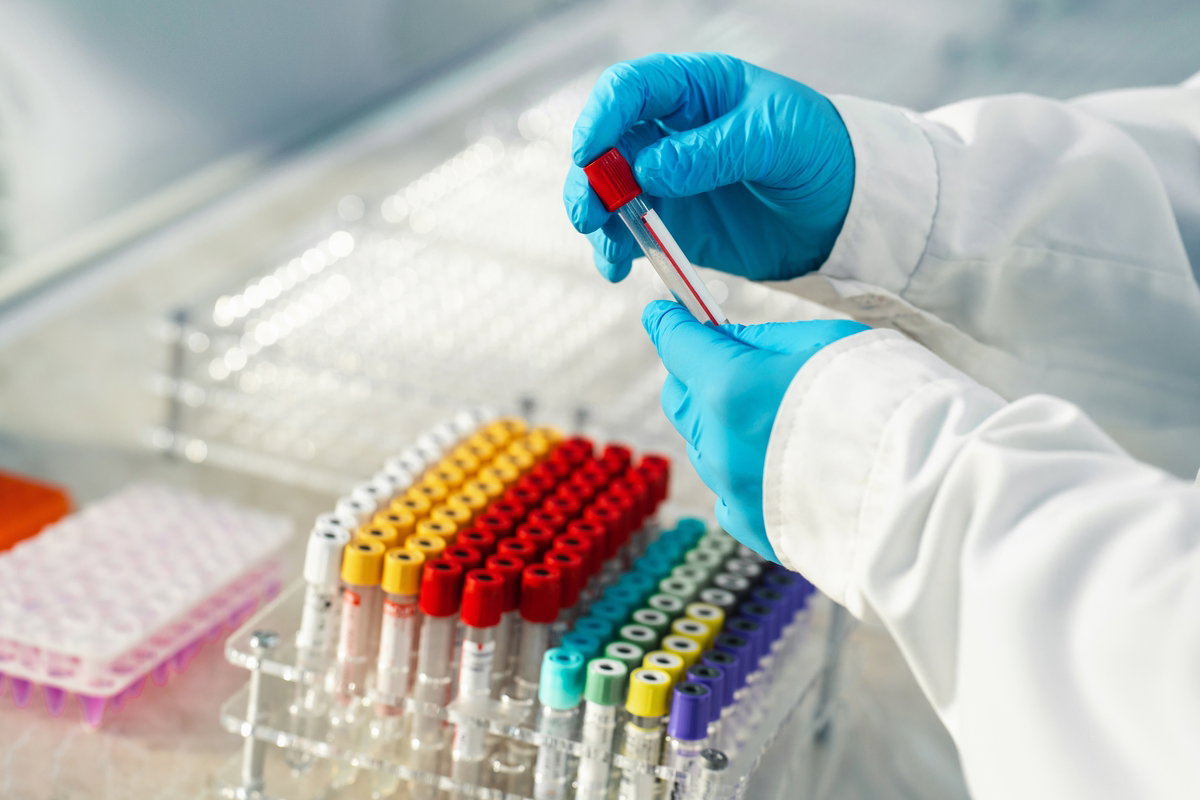 Red Blood Cells: Normal Range & What Results Mean - Tua Saúde