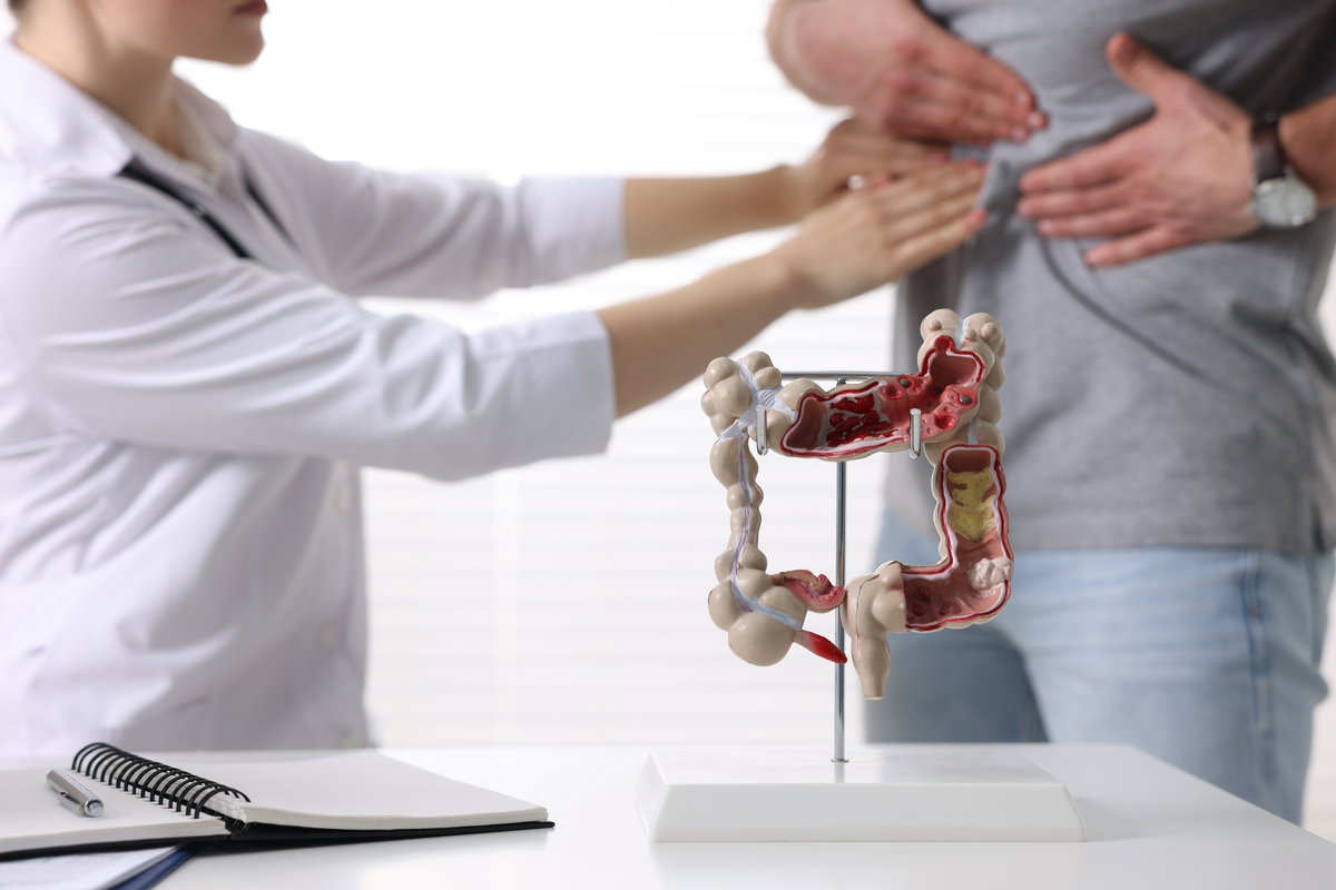 Candidíase intestinal: o que é, sintomas, causas e tratamento - Tua Saúde