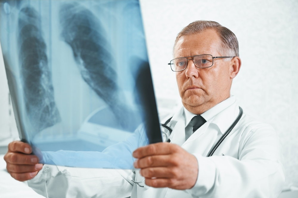 Traqueobronquite: o que é, sintomas, causas e tratamento - Tua Saúde