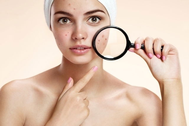 Infecciones en la piel: tipos, síntomas y tratamiento - Tua Saúde